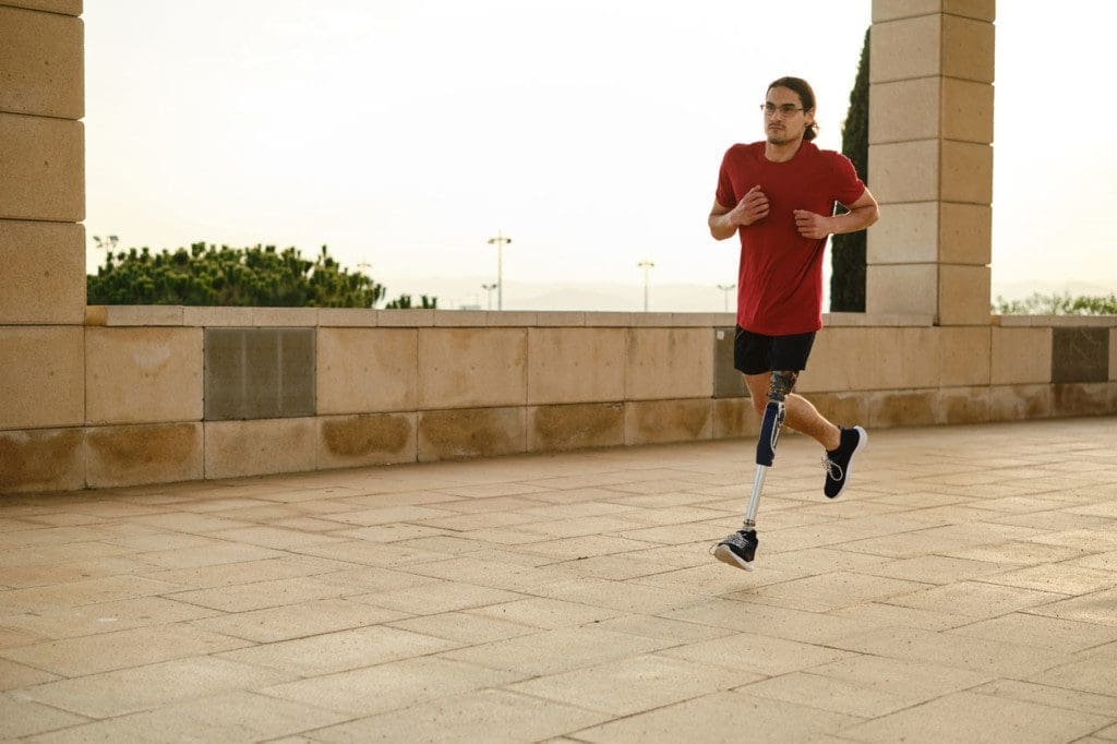 Running With A Prosthetic Leg: Sciatica Clinic